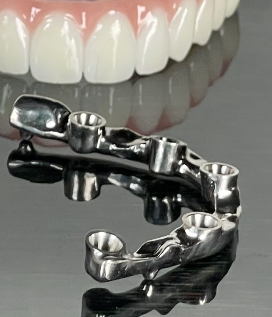 Gallery – Digital Edge Dental Lab